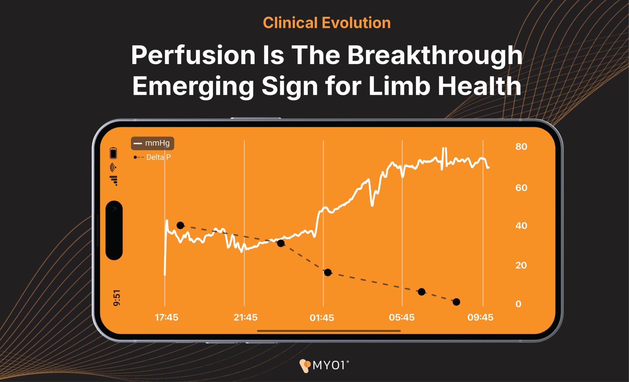 Perfusion Pressure FDA Clearance – MY01